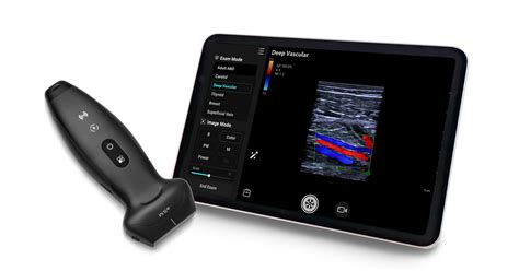 Mindray Introduces Te Air E5m Wireless Handheld Ultrasound To Revolutionize Whole Body Scanning