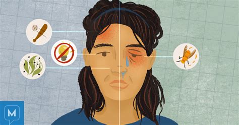 Migraine Vs Cluster Headaches Whats The Difference