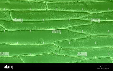 Plant Epidermis Diagram