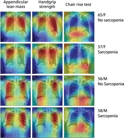 Gradient‐weight Class Activation Mapping For Deep Neural Network Models Download Scientific