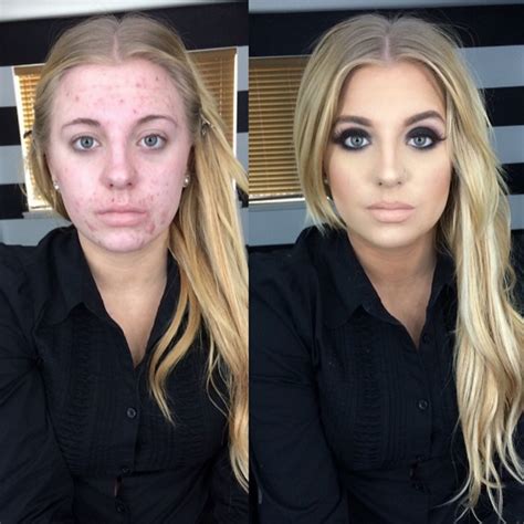 This Womans Before And After Photo Became A Nasty Internet Meme And