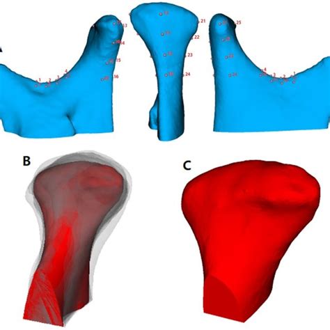 A 25 Landmark Registration For Surface Model Approximation B Download Scientific Diagram