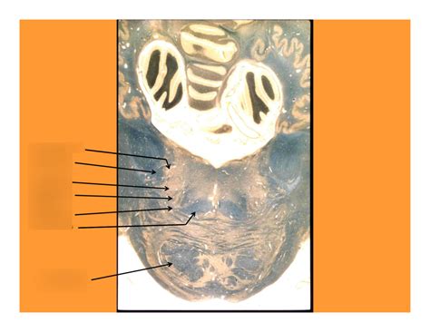 Brain Stem Slice 6 Diagram Quizlet