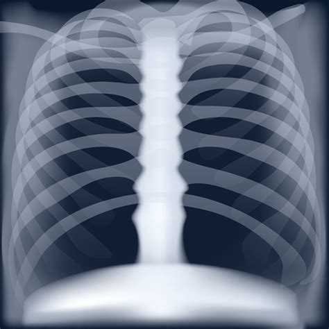 Xray Medical Image Of Chest 29278532 Vector Art At Vecteezy