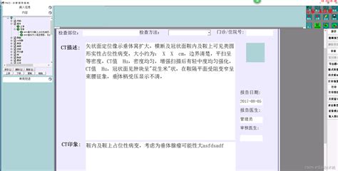 医学影像信息系统 Pacs源码 基本概况和工作原理 Pacs影像传输调试原理 Csdn博客