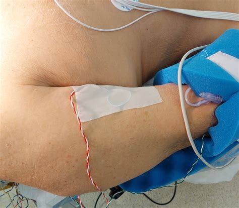 Ionm Intraoperative Neuromonitoring Miami Dade