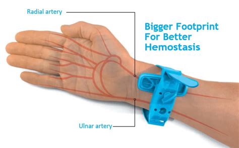Radial Compression Devices Mediterra View The Product Range