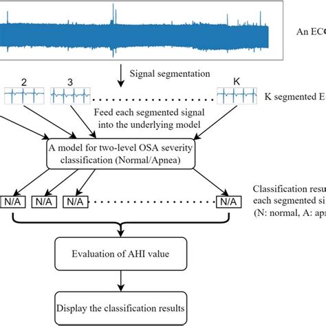 An Electrocardiogram Ecg Signal Must Be Segmented As A Pretreatment Download Scientific