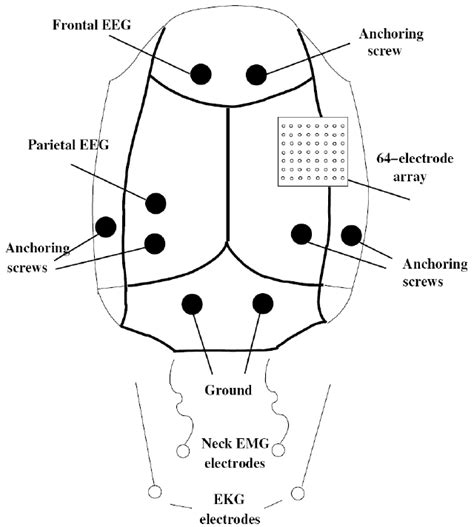 Electrode Matrix And Its Position Over The Cortex Download Scientific