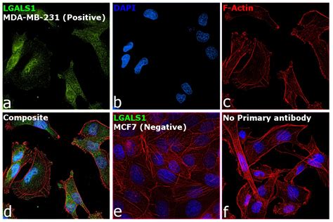 Galectin 1 Antibody Ma5 32779