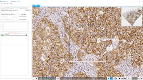 Halo® Halo Ai And Halo Link 3 6 Features And Functionalities Indica Labs