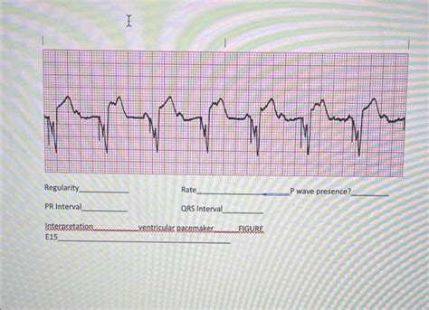 Solved Regularity Rate PR Interval QRS Interval Chegg Com