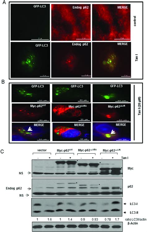 The P62 Δuba Domain Is Responsible For The Colocalization Of Lc3ii And Download Scientific