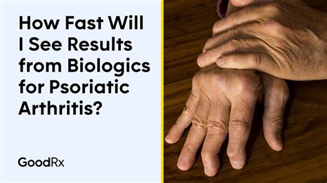When To Expect Results From Using Biologics To Treat Psoriatic