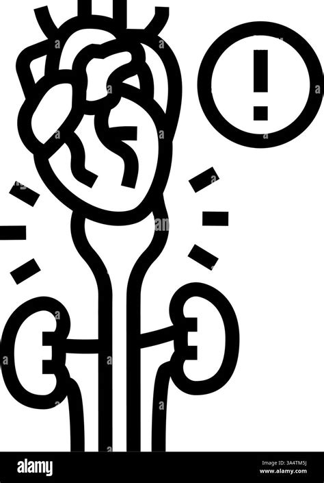 Aortic Aneurysm Cardiology Disease Line Icon Vector Illustration Stock