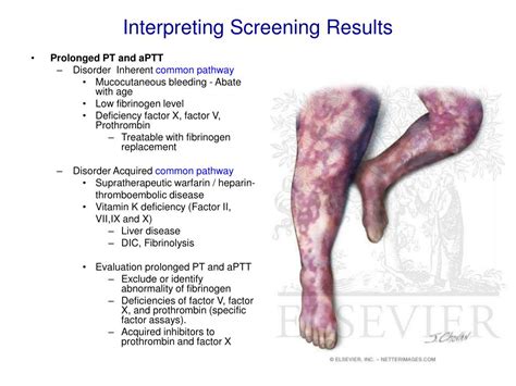 Ppt Bleeding Diathesis Powerpoint Presentation Free Download Id