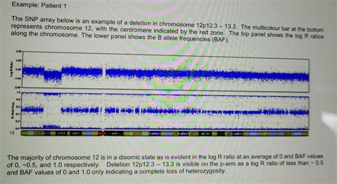 Solved Example Patient 1 The Snp Array Below Is An Example