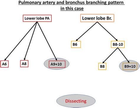 Left S9 And 10 Double Segmentectomy Springerlink