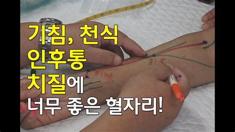 [김효열 교수의 재미있는 혈자리 공부] 인후통 기침 천식 치질 등에 좋은 혈자리 수태음폐경 Youtube