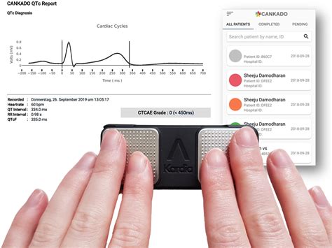 Corrected Qt Interval Qtc Diagnostic App For The Oncological Routine