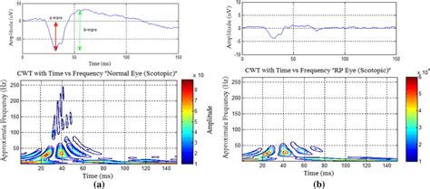 Contour Plot Generated By The Morlet Based CWT A A Normal Sample