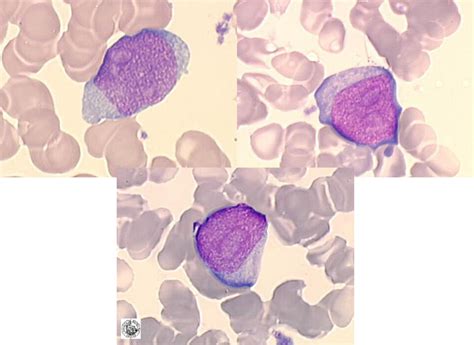 Lymphocytes Monocytes Blastes Plasmocytes Ostéoblastes