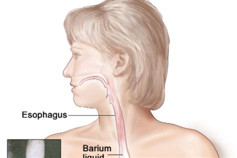 위장조영촬영 검사 받는 이유 알 수 있는점 절차 및 과정 위험성과 부작용 등 다양한 정보 건강한 삶을 리뷰하는 Heeee
