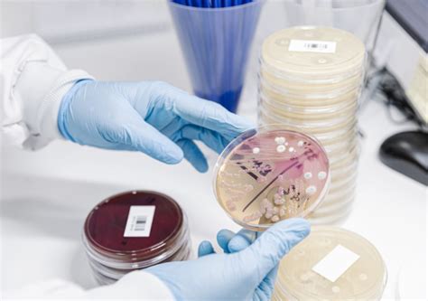 Hidden Threat The Rise Of Deadly Fungal Pathogens