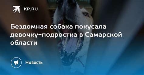 Бездомная собака покусала девочку подростка в Самарской области Kp Ru