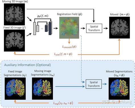 基于深度学习的单模医学图像配准综述（附voxelmorph配准实例和代码） 知乎