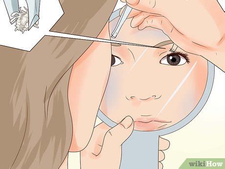 Ways To Get Rid Of Pubic Lice WikiHow