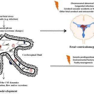 The Choroid Plexus CSF Nexus In Ventriculomegaly The Figure Depicts Download Scientific