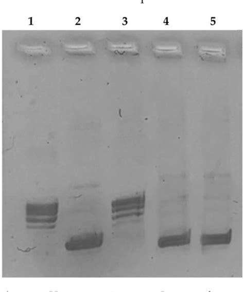 Figure 3 From Synthesis Of Novel N Heterocyclic Carbene Ruthenium Ii Complexes Precious