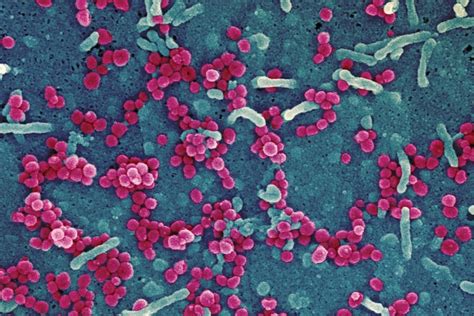 Cidrap Releases Randd Roadmap For Producing Tools To Combat Lassa Fever University Of Minnesota