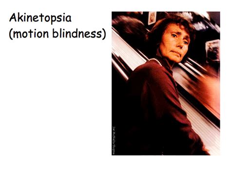 Perception Lecture Notes Visual Motion Perception