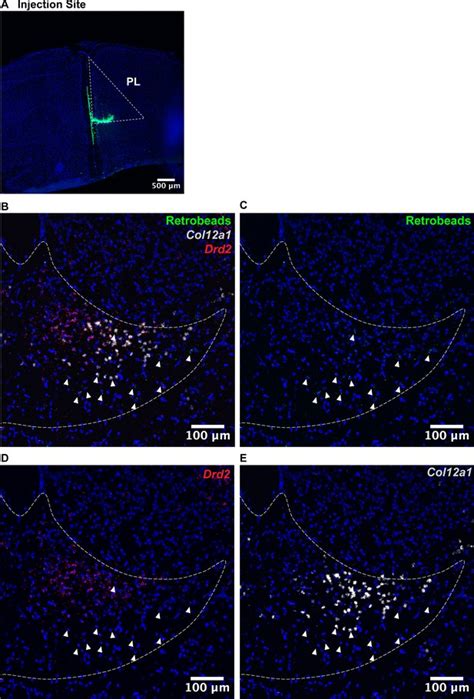 Figures And Data In Molecular And Spatial Profiling Of The Paraventricular Nucleus Of The