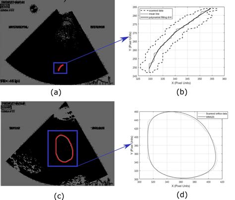 A Valve Leaflet Segmented Image B Leaflet Scanned Data Mean Line Download Scientific