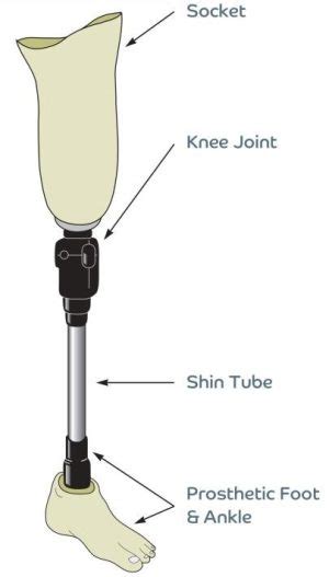 What Are The Parts Of A Prosthesis Bedfordshire Hospitals Nhs Trust