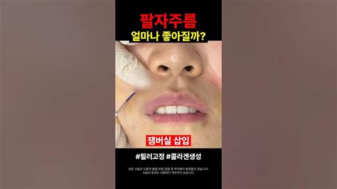 팔자주름 이동이 걱정되나요 얼마나 좋아질까 잼버실필러 Modsclinic 모즈클리닉 잼버실 팔자필러 필러