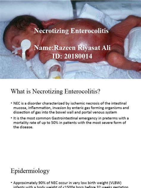 Necrotizing Enterocolitis Pdf Medical Specialties Clinical Medicine