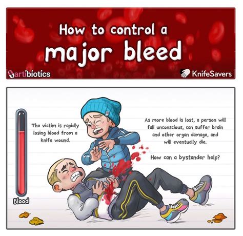 Brown Journal Of Hospital Medicine On Twitter How To Control A Major