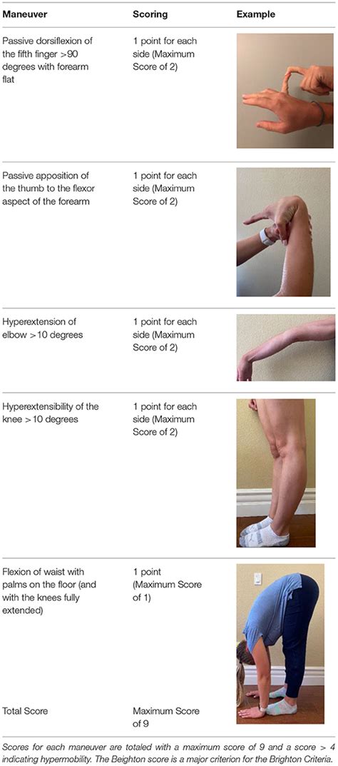 Frontiers Hypermobile Disorders And Their Effects On The Hip Joint