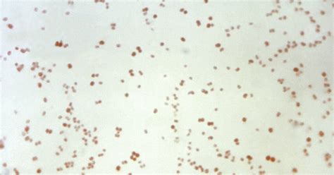 Std Sti Cases Rise Yearly So Why Isnt The Us Making Any Progress