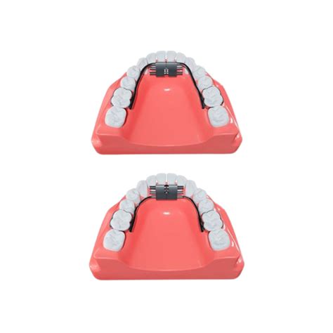 Tornillo Hyrax Morelli Ortotek