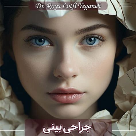 جراحی بینی در تهران بررسی 0 تا 100 عمل بینی به همراه نمونه کار دکتر