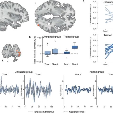 Learning To Read Strengthens Cortico Subcortical Functional Download Scientific Diagram
