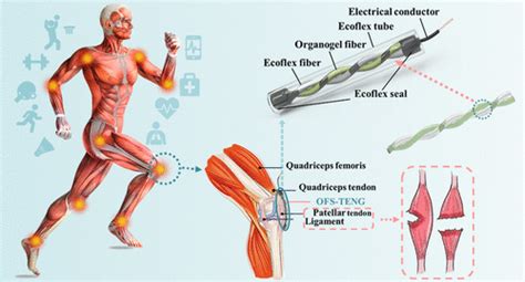 Ultrastretchable Organogelsilicone Fiber Helical Sensors For Self Powered Implantable Ligament