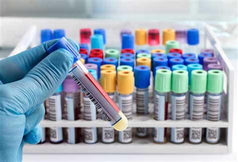 Étude De Biologie Médicale Bts Analyses De Biologie Médicale Fbryu