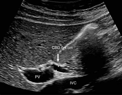 Cbd Normal Size Whats The Best Cbd Dosage