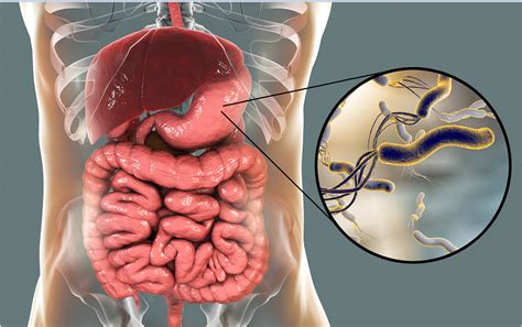 Helicobacter Pylori Detection Method Non Invasive Detection Creative